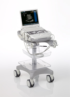 Siemens-Acuson-P300-Portable-Ultrasound-Machine